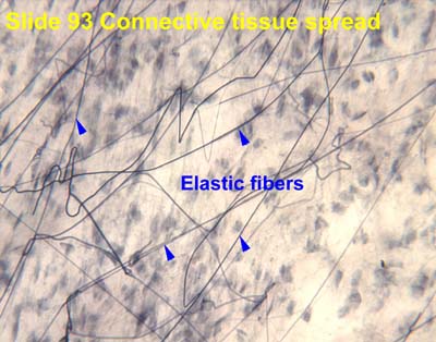 HISTOLOGY PICTURES: Connective Tissue