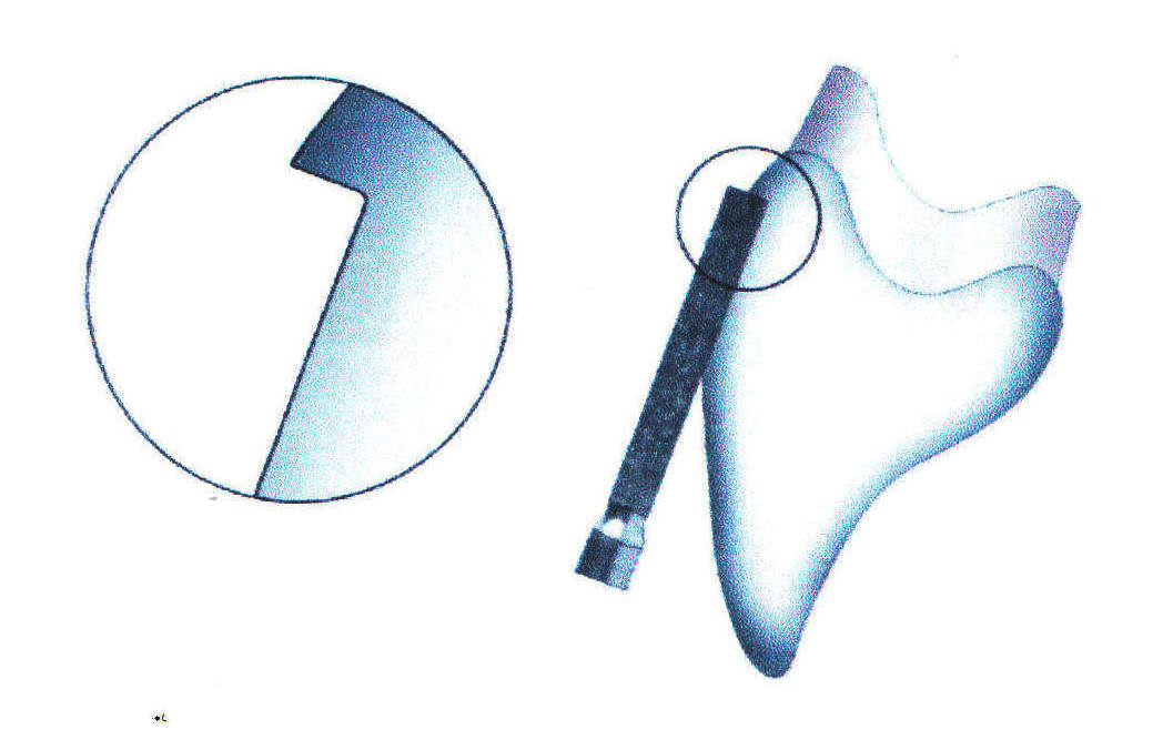 Muito bom esse café !: Linhas de terminações ( Prótese Fixa)