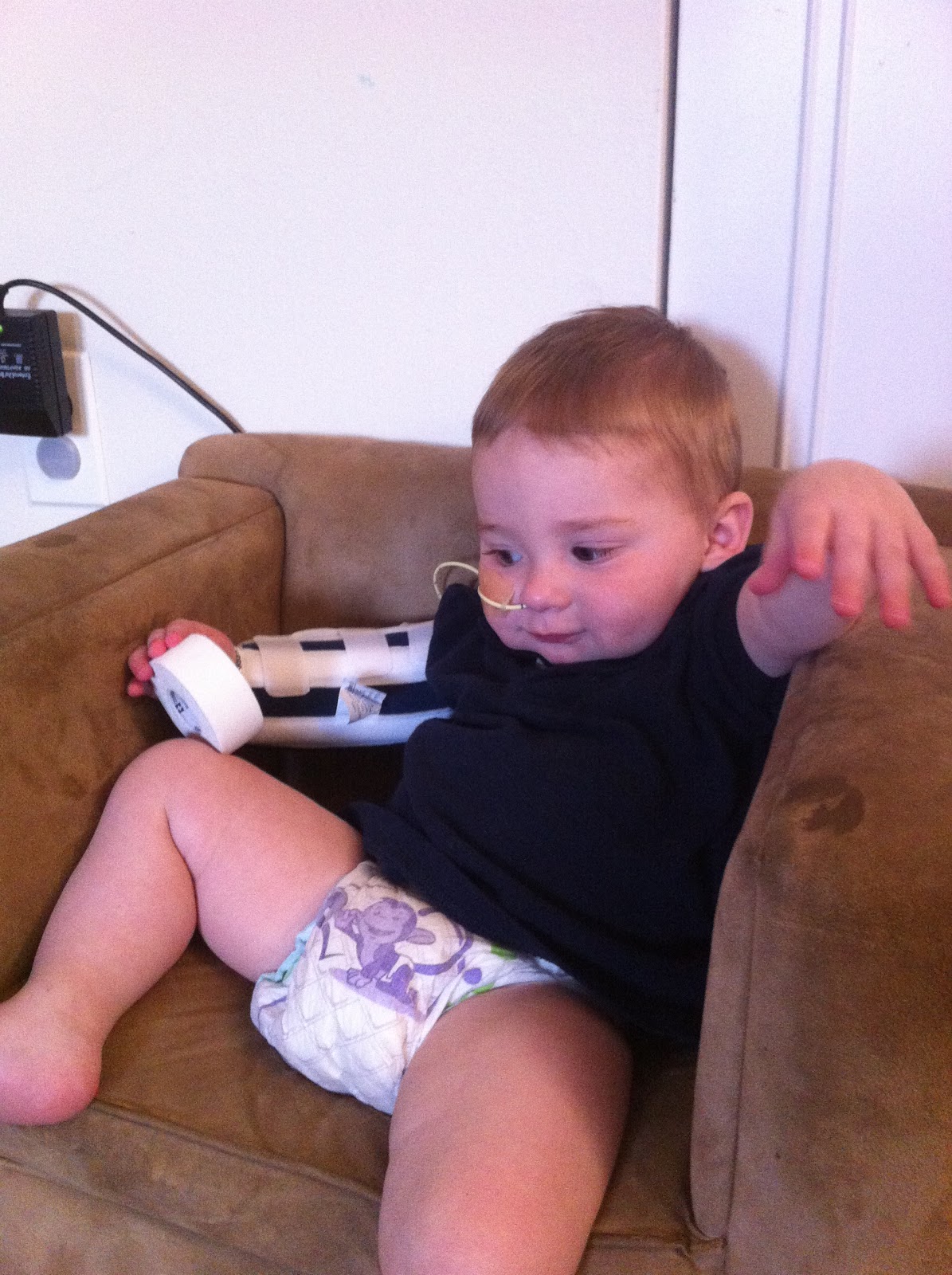 Aidan... With Eos: Feeding Tube: Tube Day