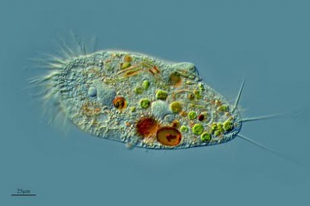 Deskripsi, Reproduksi dan Contoh Protista Mirip Hewan Sub Bab Ciliata ...