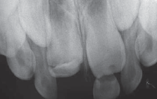 Dentistry and Medicine: Dental Trauma-Paediatric Emmergency Department ...