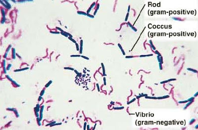 Gram staining - Procedure, mechanism, explanation ~ Medicine Hack