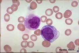 HEMATOLOGIA: Promonocito