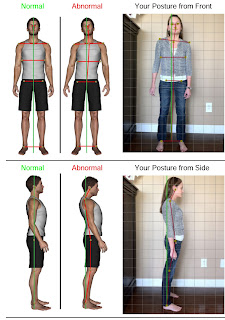 Vital Living: Posture Assessment- Back To School
