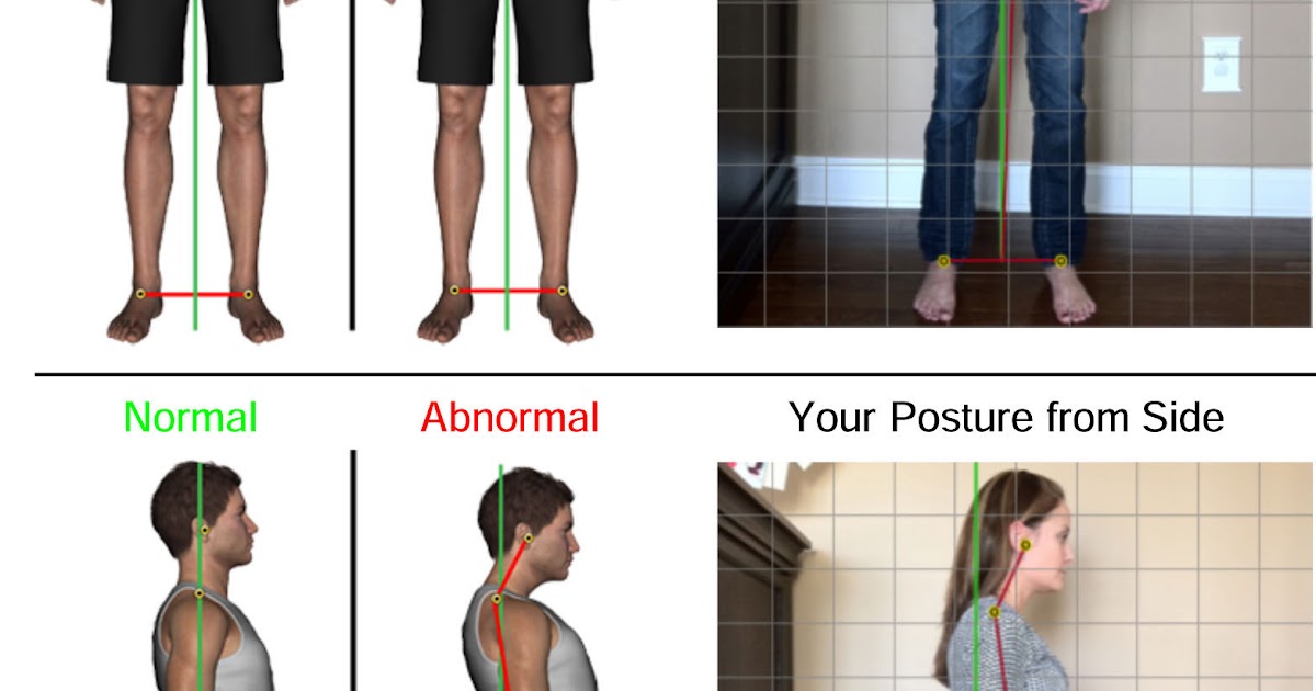 Vital Living: Posture Assessment- Back To School