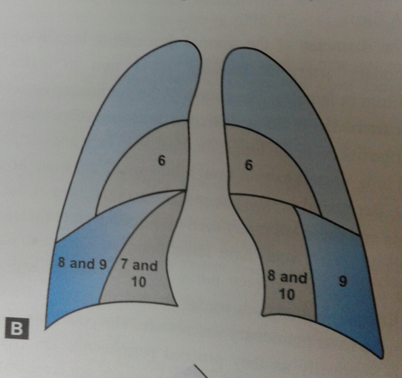 diagnostic radiology imaging: Normal Anatomy on chest X-ray