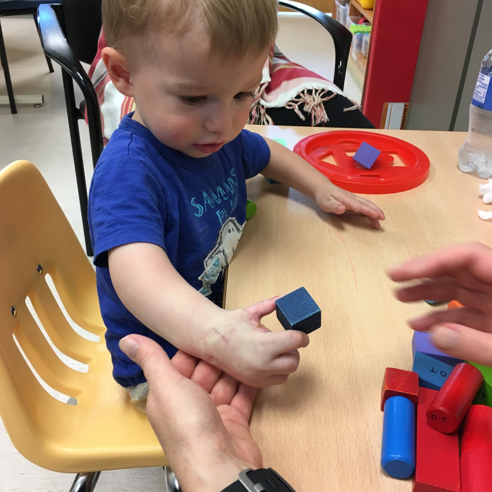 Rebuilding the Mirror Hand | Congenital Hand and Arm Differences ...