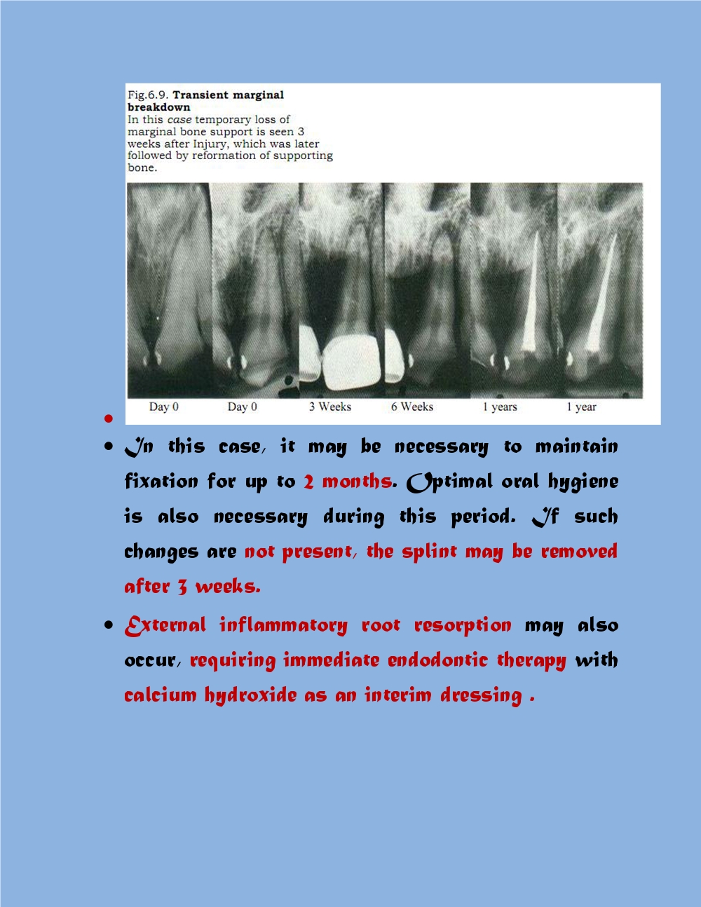 DOs and DONTs in DENTISTRY: CONCUSSION ,SUBLUXATION,EXTRUSION ,LATERAL ...