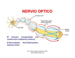 #VisiónAris: Nervio óptico