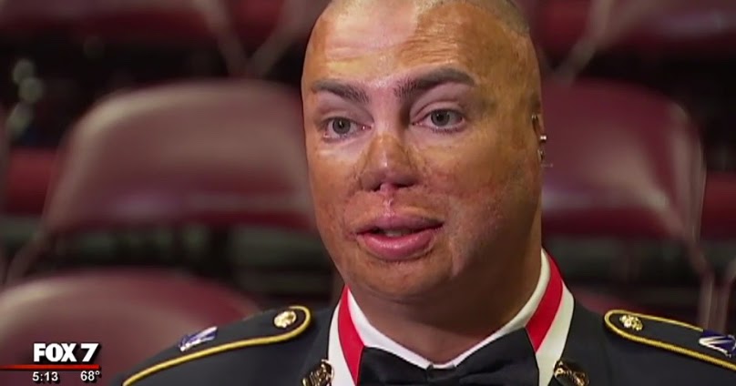 Wounded Times: Staff Sgt. Shilo Harris, Combat Wounded Soldier Feeling ...
