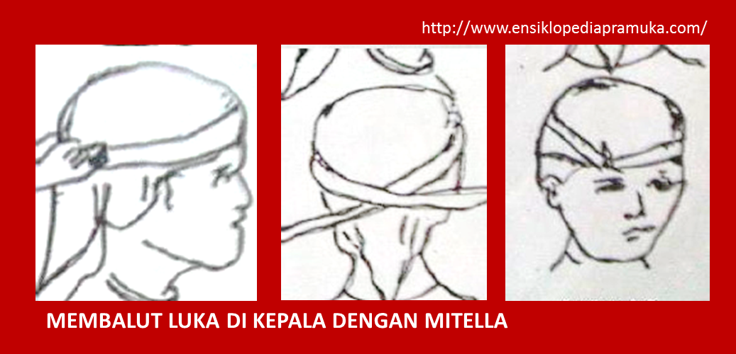 PPPK : Teknik Pembalutan