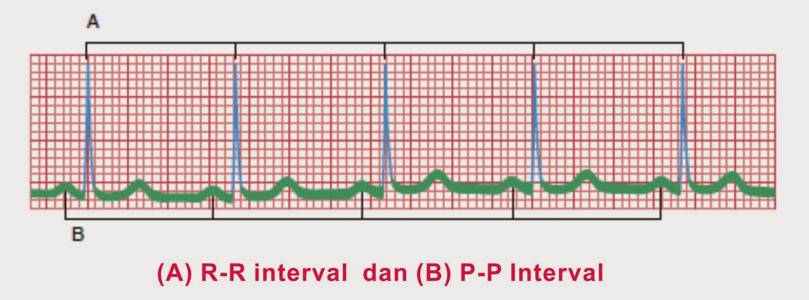 Interval Pada EKG