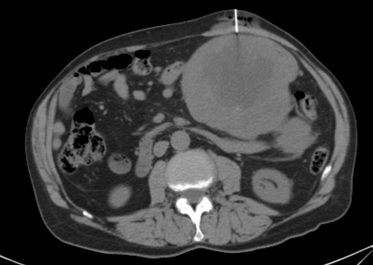 Radiology Station: GIST