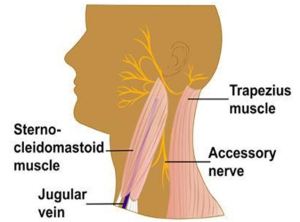 Dissecting the neck dissection - Head & Neck Cancer Support Aotearoa