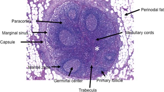 The Arts, Sciences and Medicine: LYMPHOMA ...an understanding?