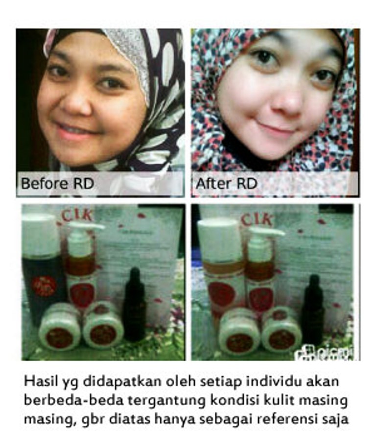PERAWATAN CANTIK ARTIS: CREAM RD ORI TERMURAH IJIN BPOM HALAL KULIT ...