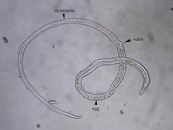 Lecture Notes in Medical Technology: Lecture #2: THE INTESTINAL NEMATODES