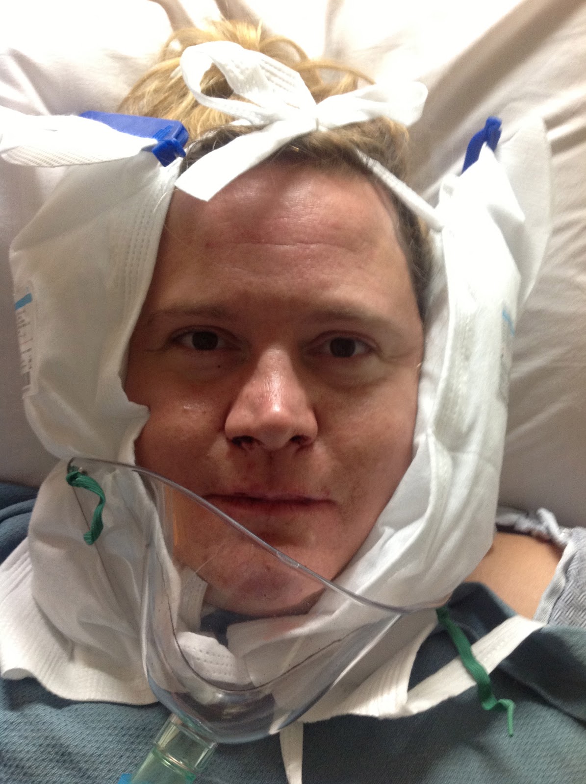My Journey thru MMA Surgery for my Sleep Apnea