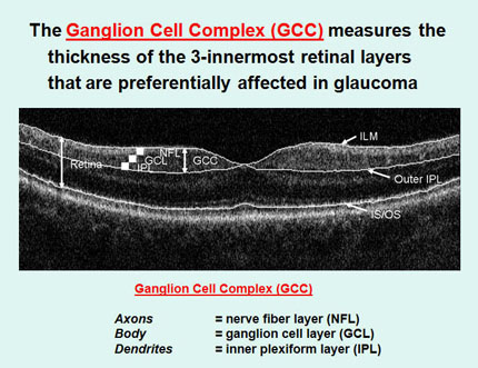 GLAUCOMA SPECIALIST BLOG: "THE GLOG"