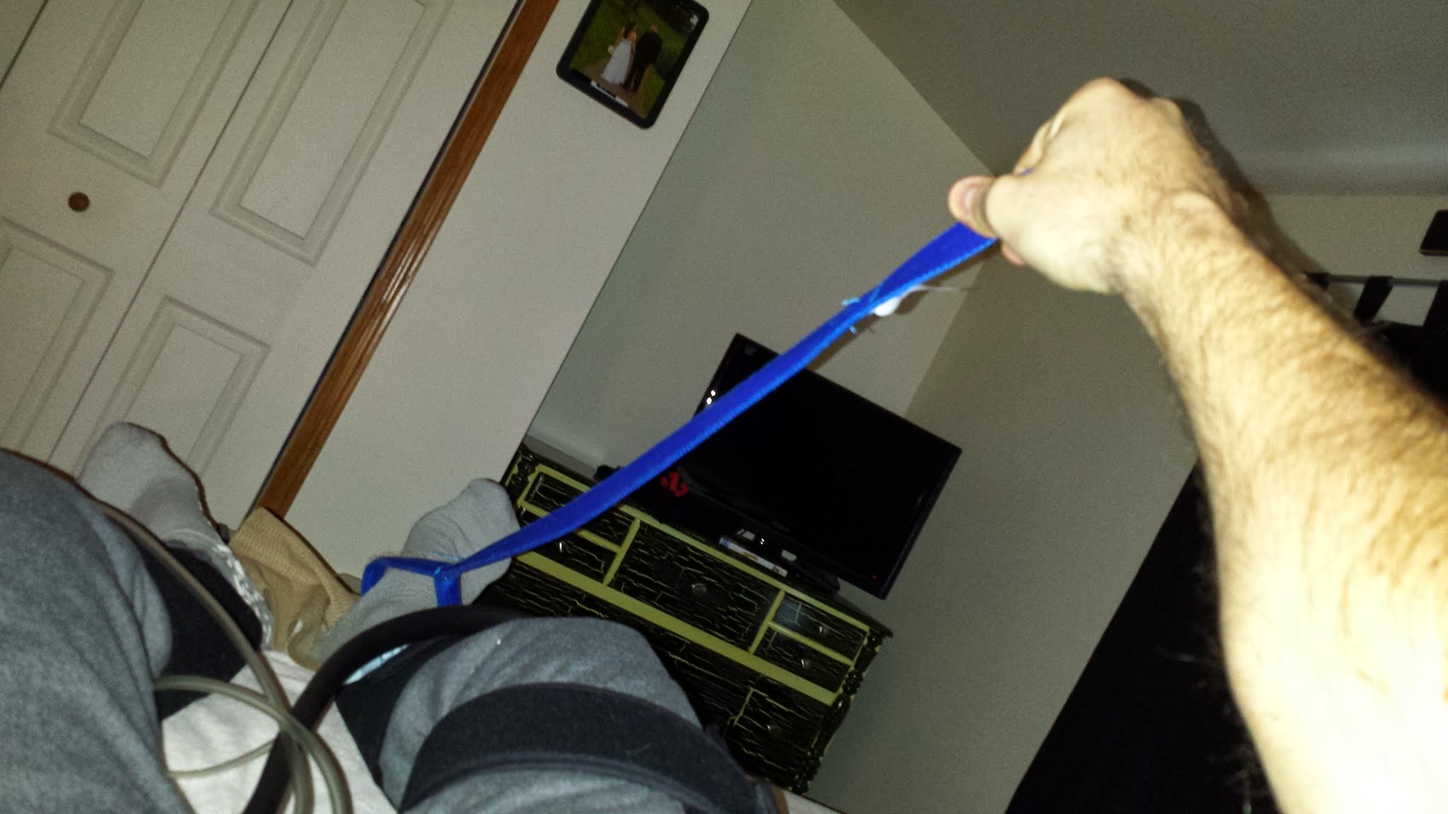 FAI *Femoroacetabular Impingement* Arthroscopic Hip Surgery: Injury to ...