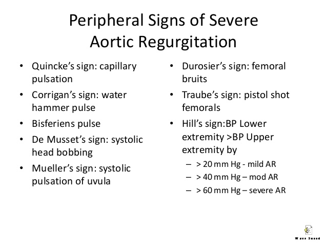 Jewels of Clinical Medicine: Signs of severity of AR