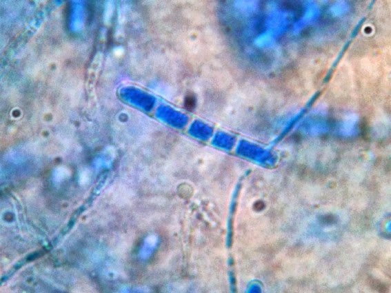 Fun With Microbiology (What's Buggin' You?): Trichophyton terrestre