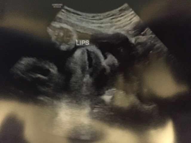 AbbasGirl (and the family): 34 week ultrasound