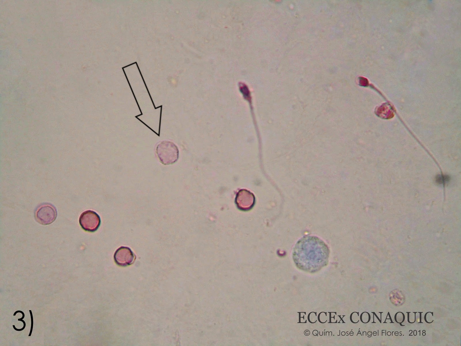 Examen General de Orina: enero 2018