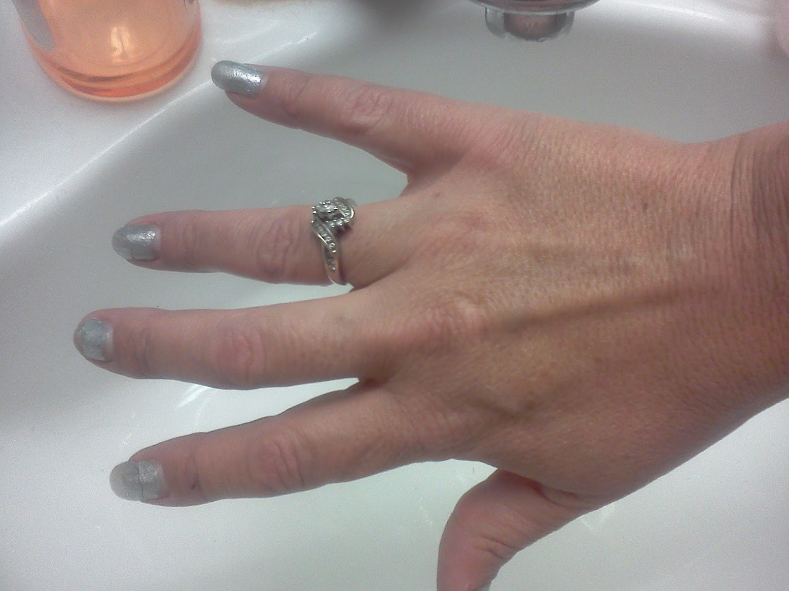 Life with Lupus: Symptoms from mild to severe. These are just a few.