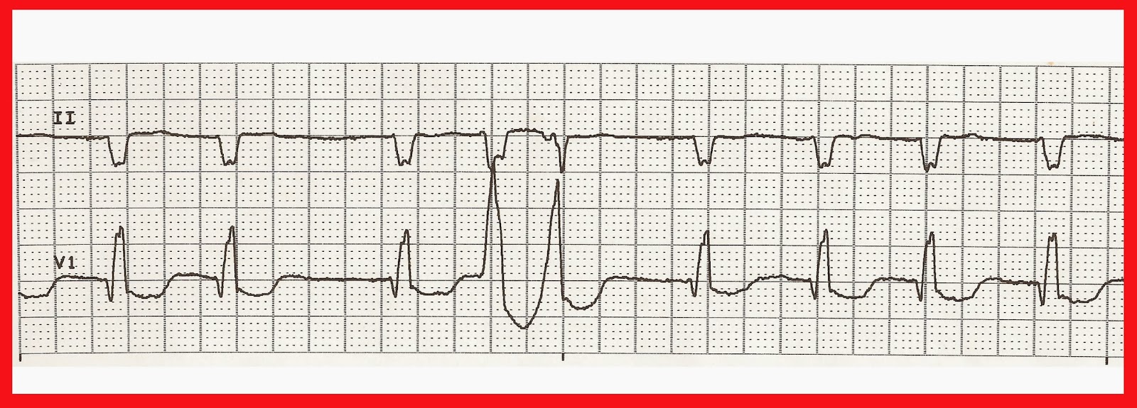 EKG Rhythm Strip Quiz 192