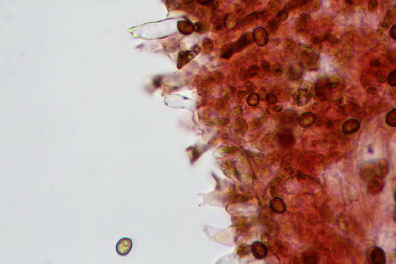 El mundo microscópico de los hongos: Agaricus bisporus (Lge.)Sing.
