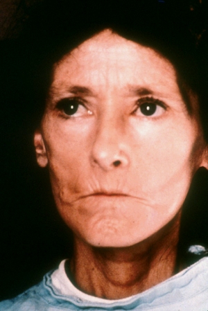 Dr. Amir's Blog: CREST Syndrome