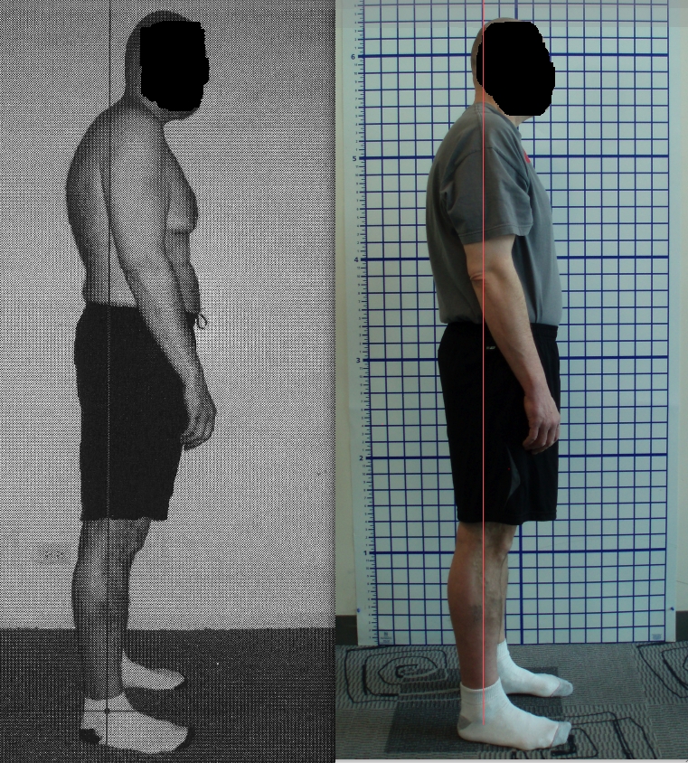 Body Trippin' Blog: A different perspective on posture and pain