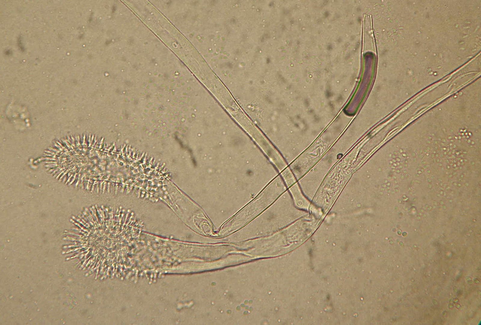 ATLAS MICOLOGIA: ASPERGILLUS CLAVATUS
