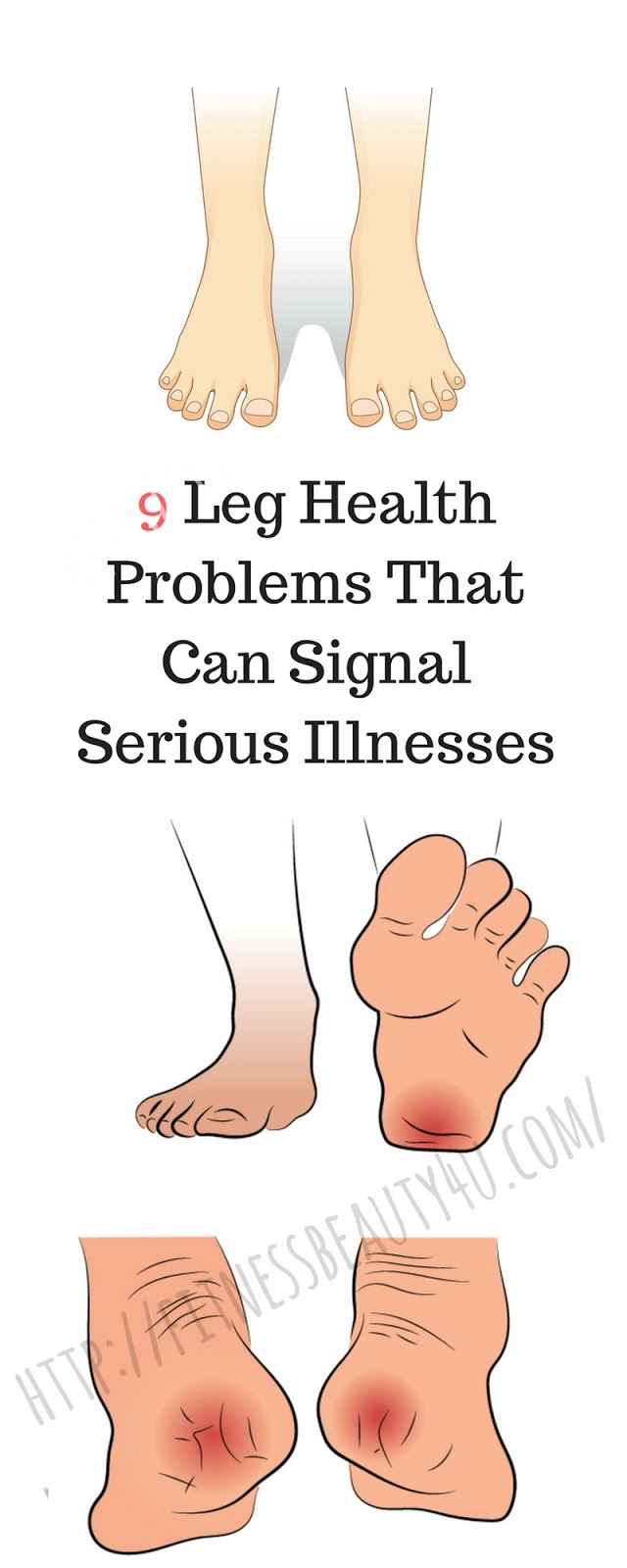 9 Leg Health Problems That Can Signal Serious Illnesses