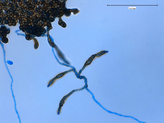 Fun With Microbiology (What's Buggin' You?): Phoma glomerata