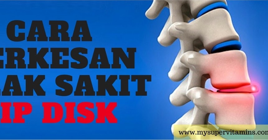 10 Cara Kurangkan Sakit Slip Disc Pada Tulang Belakang - Pengedar ...