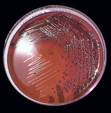 JENIS JENIS MEDIA PERTUMBUHAN BAKTERI - Yazhid Blog