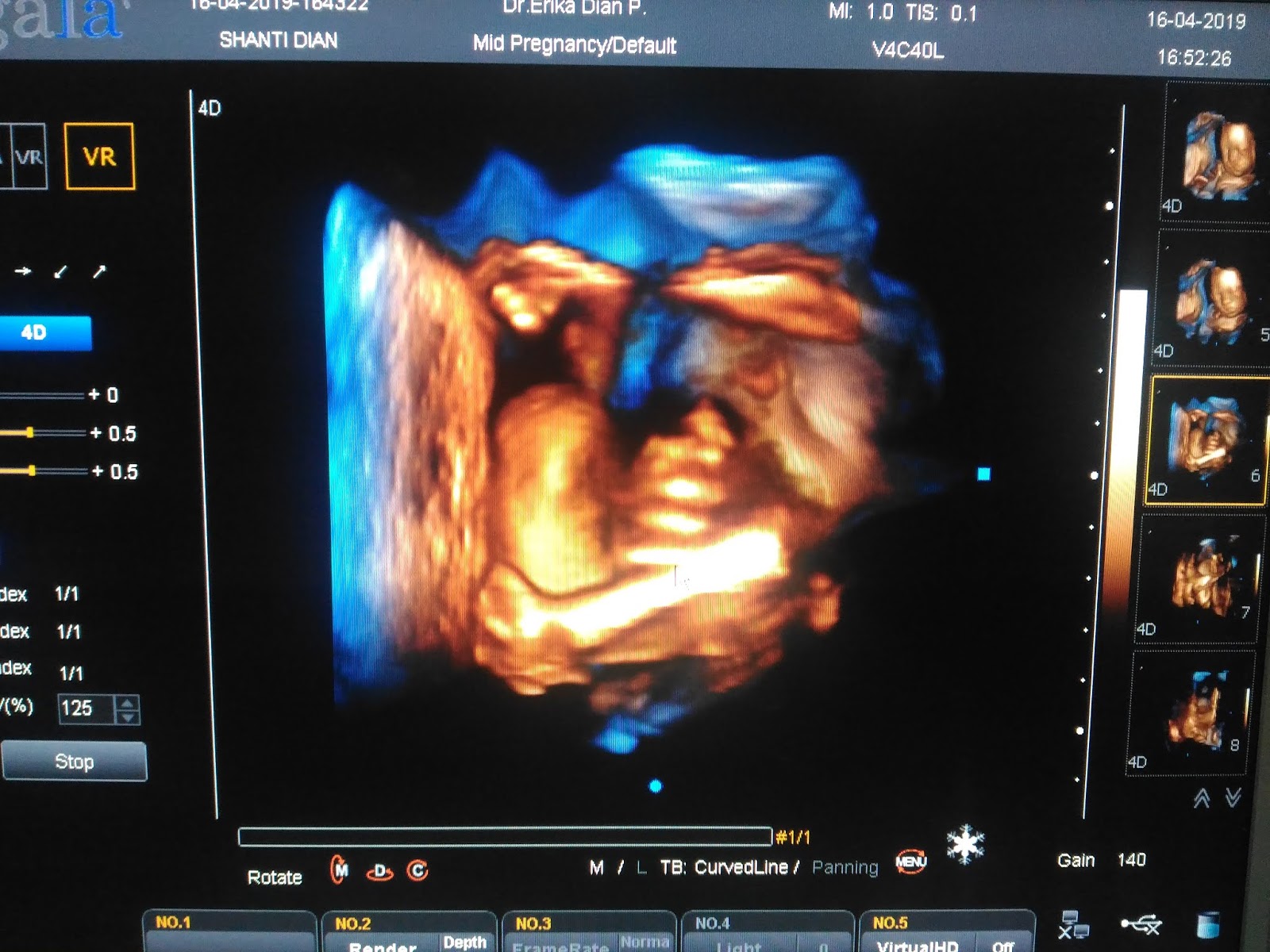 USG 4D MURAH DI SEMARANG (KLINIK PRATAMA SEHAT UTAMA) TAHUN 2019