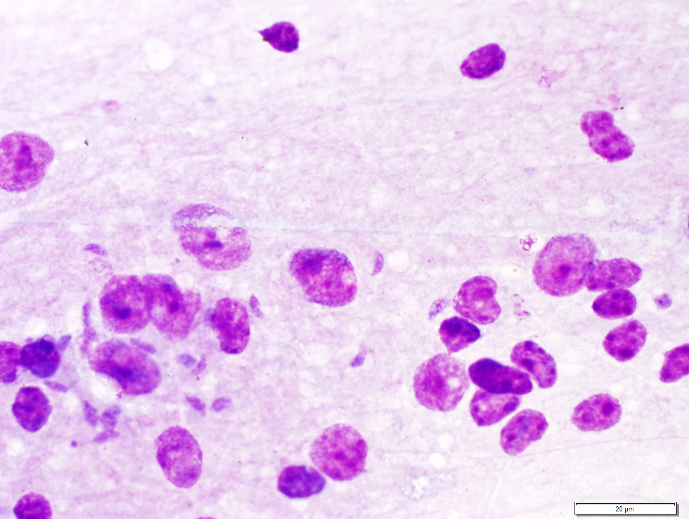 Creepy Dreadful Wonderful Parasites: Case of the Week 284