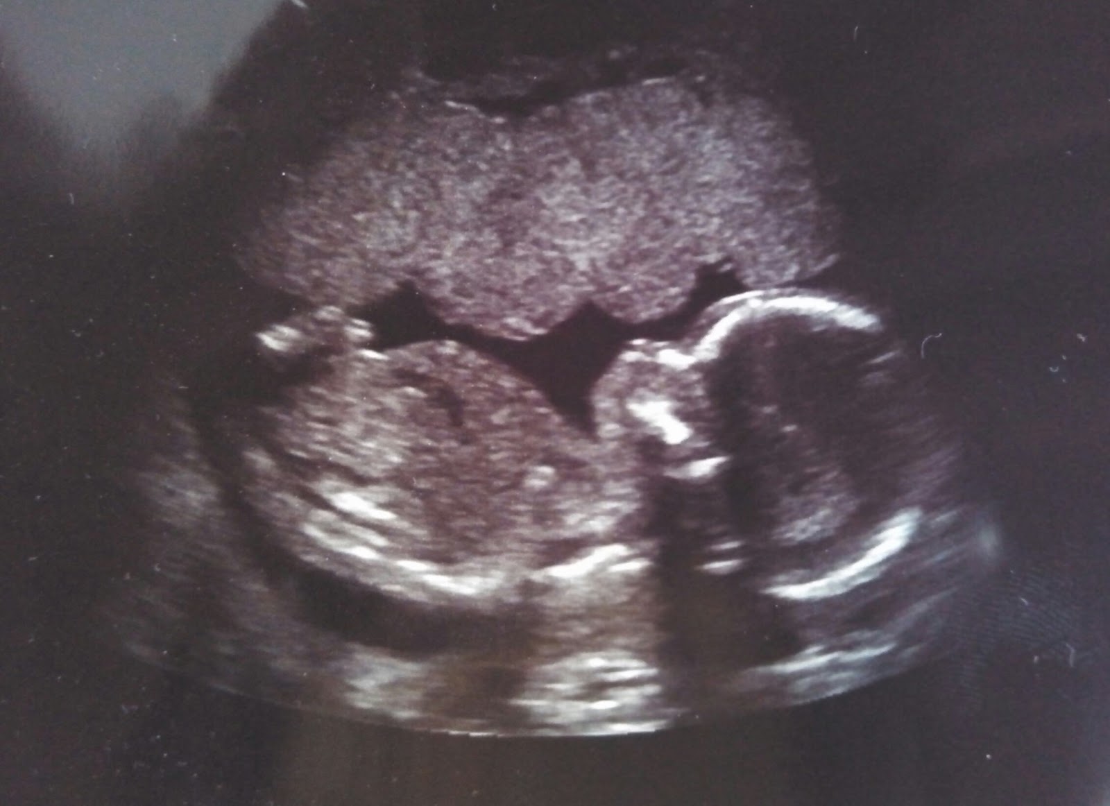 The Young Experience: 20 Weeks