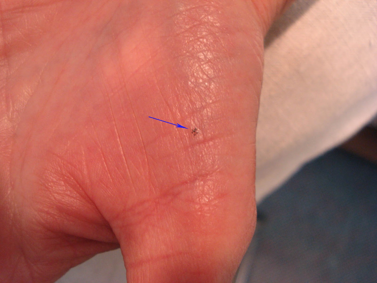 VIRTUAL GRAND ROUNDS IN DERMATOLOGY 2.0: Dermoscopy Rocks