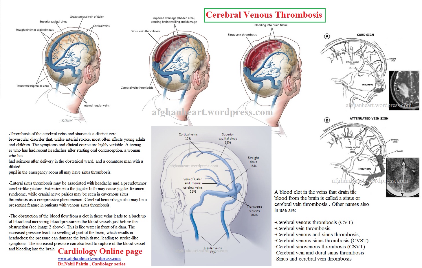 Dr.Nabil Paktin's Journal of Cardiovascular Medicine Blog ژورنال ( قلب ...