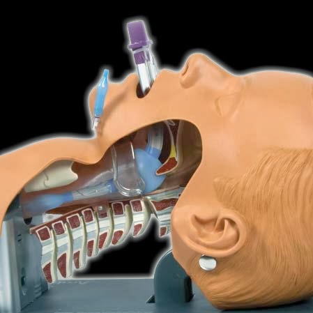 Webbingbabel: Airway Device KING LT-D , Supraglottic