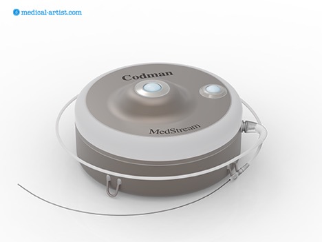 Now Without Hesitation: Me and my pump