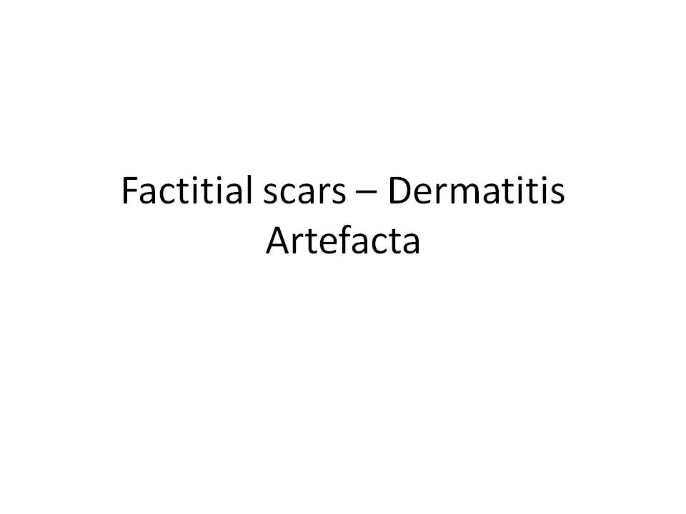 Consultations in Dermatology: Factitial scars - Dermatitis Artefacta