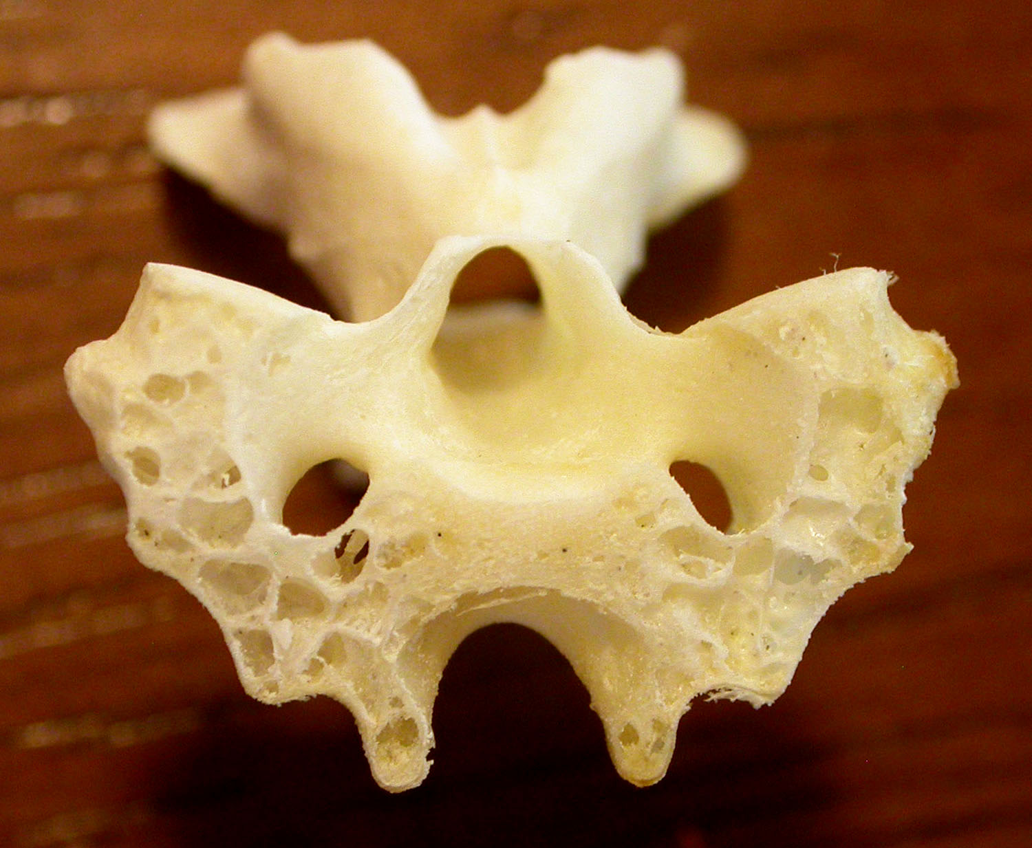 Huesos neumáticos del craneo