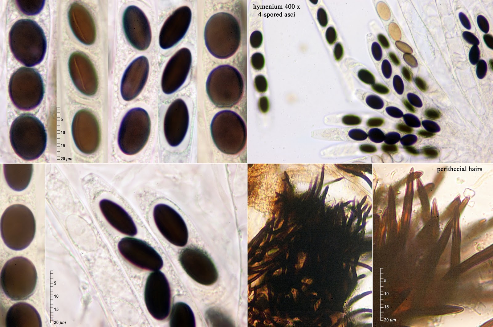 Coniochaeta tetraspora Cain • CEMAS estiercol de caballo, Somiedo