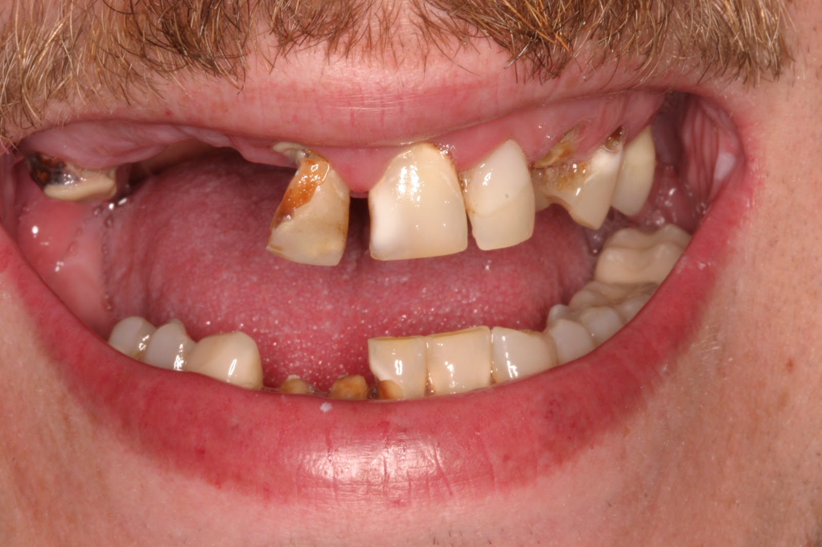 Cascadia Dentistry - Medical Dentistry,Cosmetics,& Implants: Don't Run ...