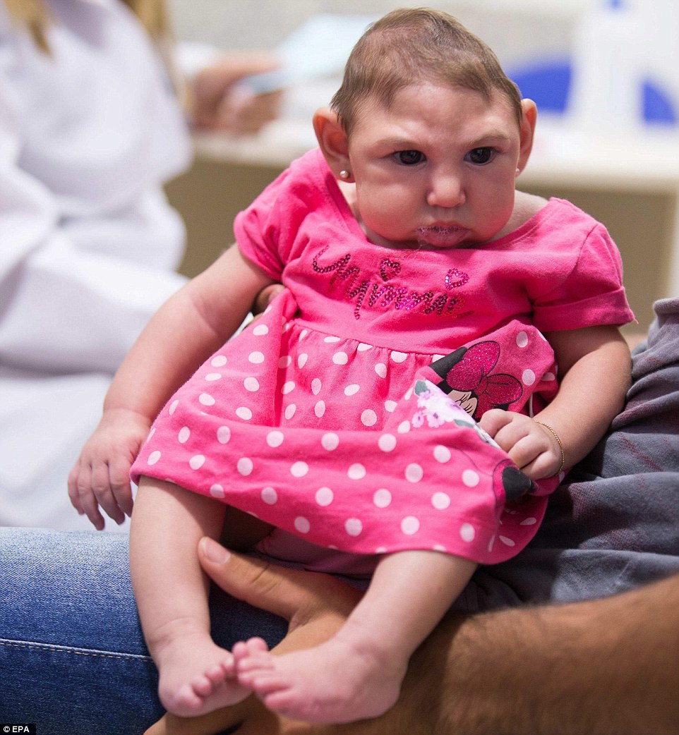 Tudo Sobre Zika Virus e Microcefalia : O Verdadeiro Horror do Vírus ...